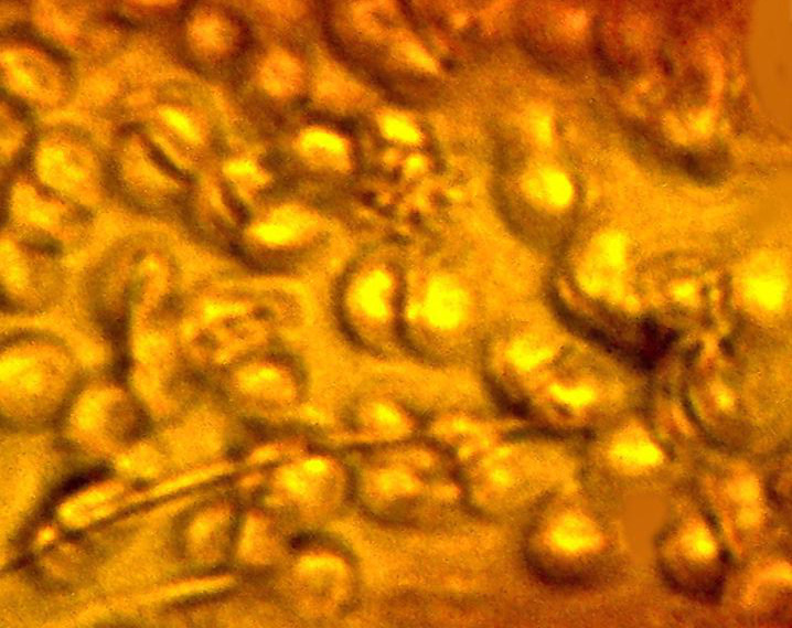 30-Million-Year-Old Tick Full of Monkey Blood Found in Ancient Amber ...