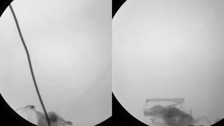 X-Ray of a Bat Taking Flight | Smithsonian Magazine